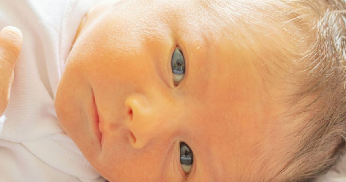 Geelzien en hyperbilirubinemie | De Verloskundige