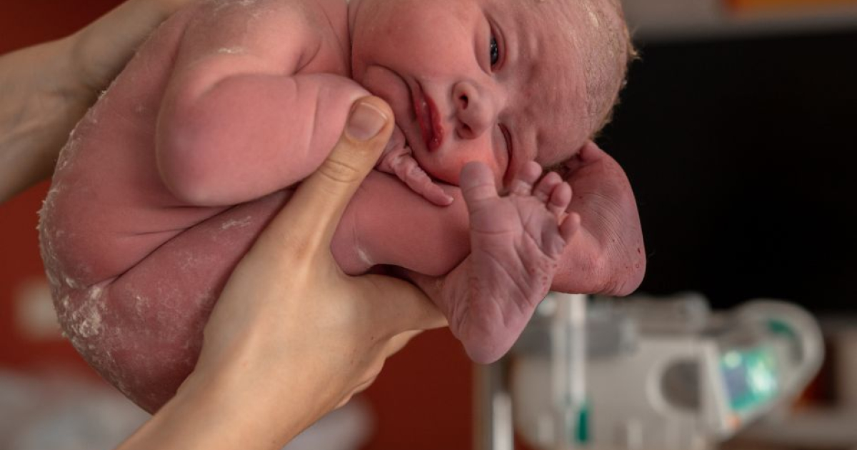 Stuitligging | De Verloskundige